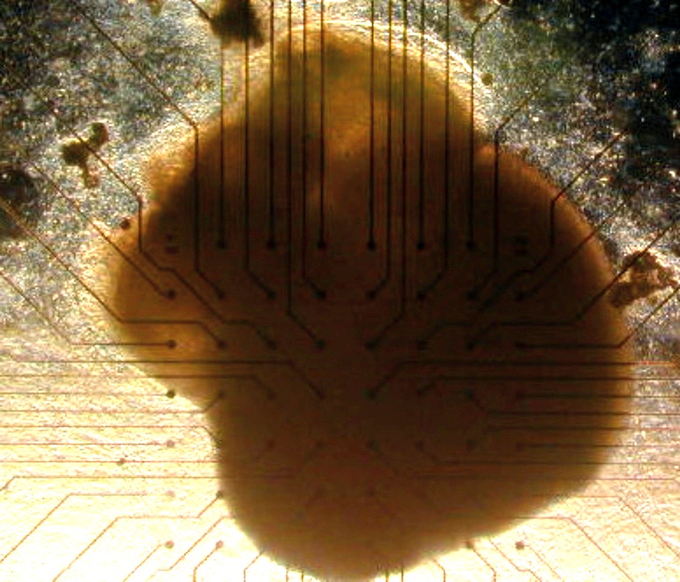 Organoid research solutions with MEA systems | Harvard Bioscience